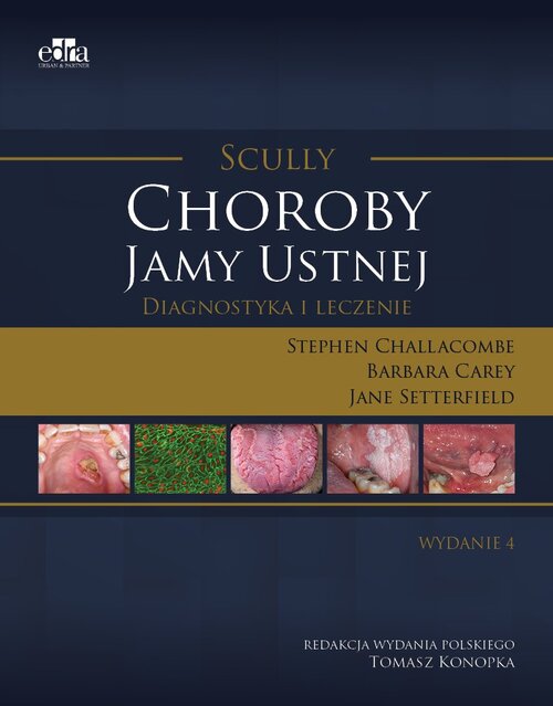 Choroby jamy ustnej. Diagnostyka i leczenie. Scully - Challacombe S ...